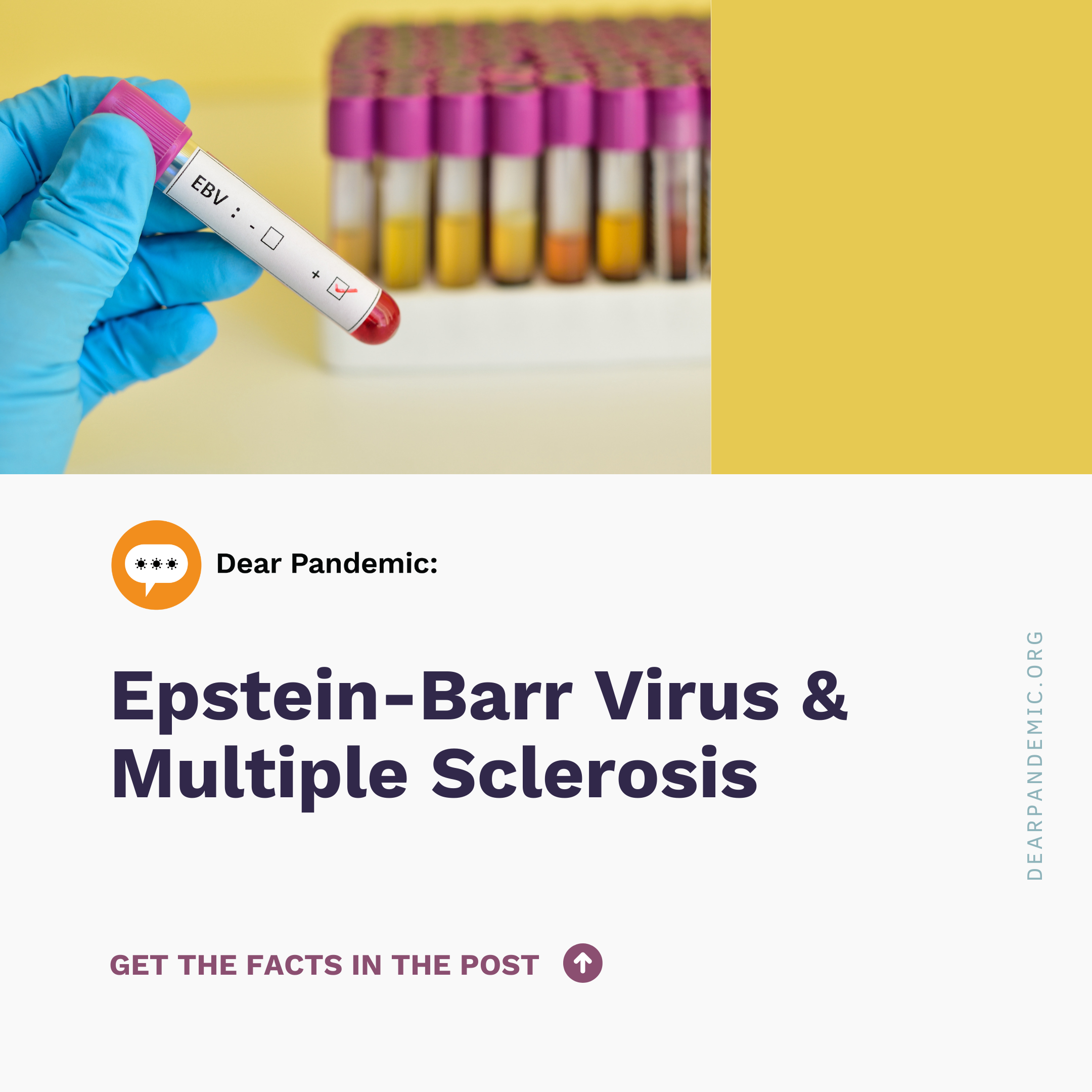 Epstein-Barr Virus & Multiple Sclerosis — Those Nerdy Girls